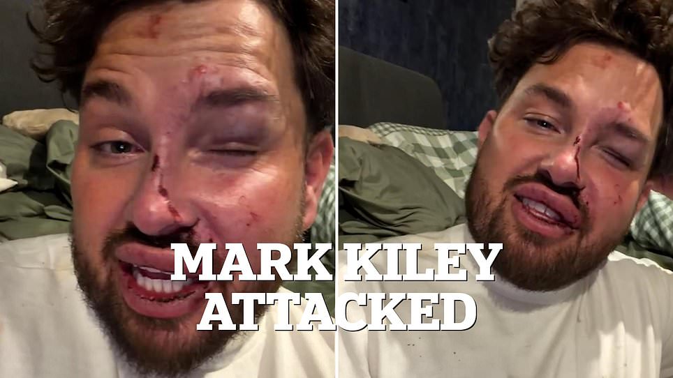 VIDEO: MAFS star Mark Kiley shocked fans by revealing the injuries he ...